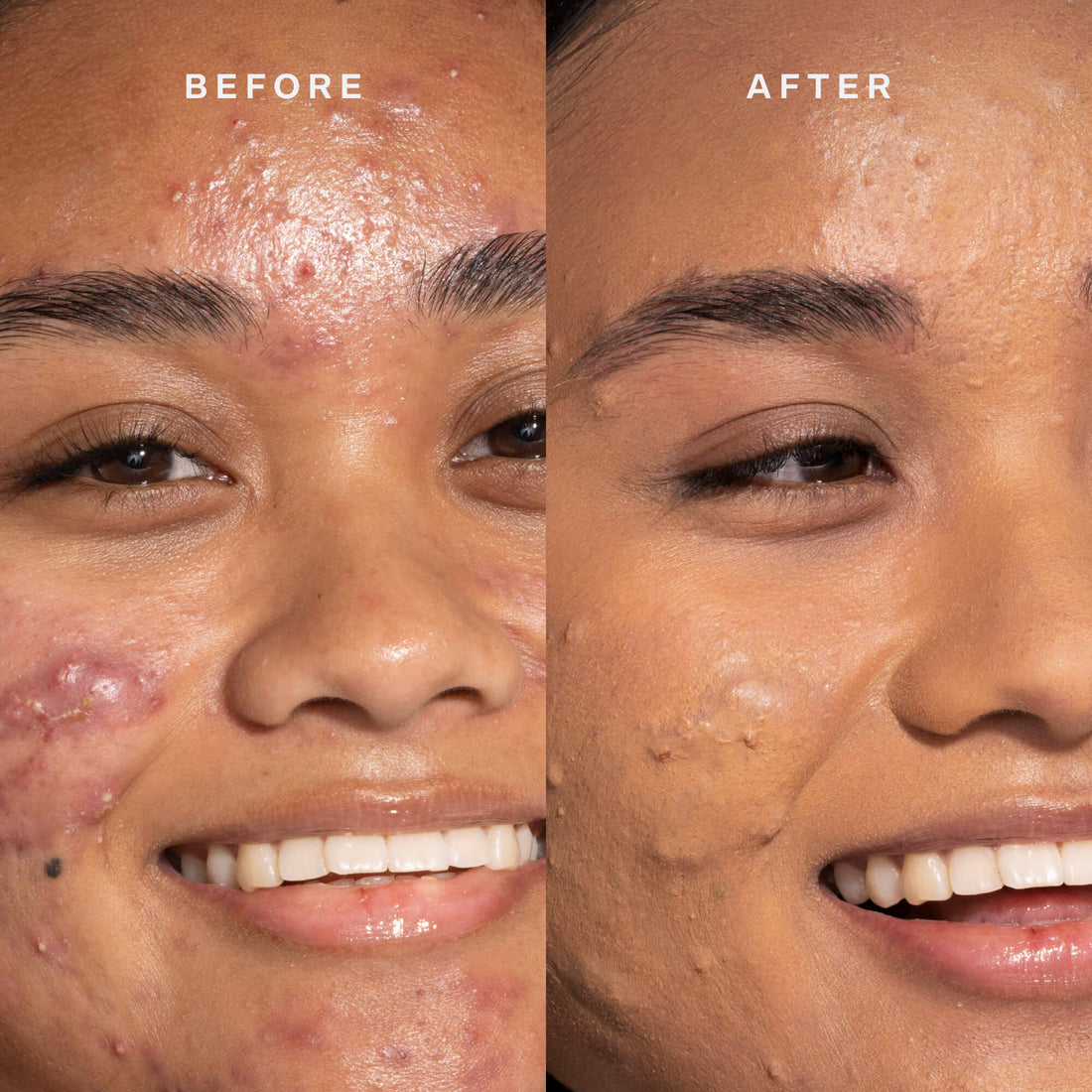 Tower 28 Everyday Base-ics | Foundation + Concealer Set – Tower 28 Beauty