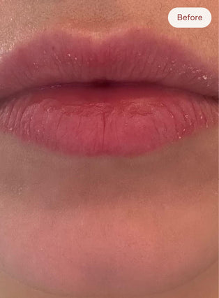 NEW SOS LipSoftie™ Lip Treatment | Tower 28 Beauty