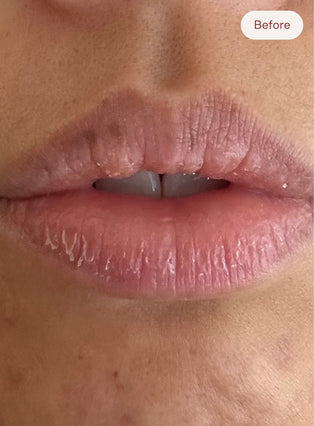 NEW SOS LipSoftie™ Lip Treatment | Tower 28 Beauty