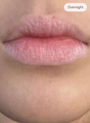 NEW SOS LipSoftie™ Lip Treatment | Tower 28 Beauty