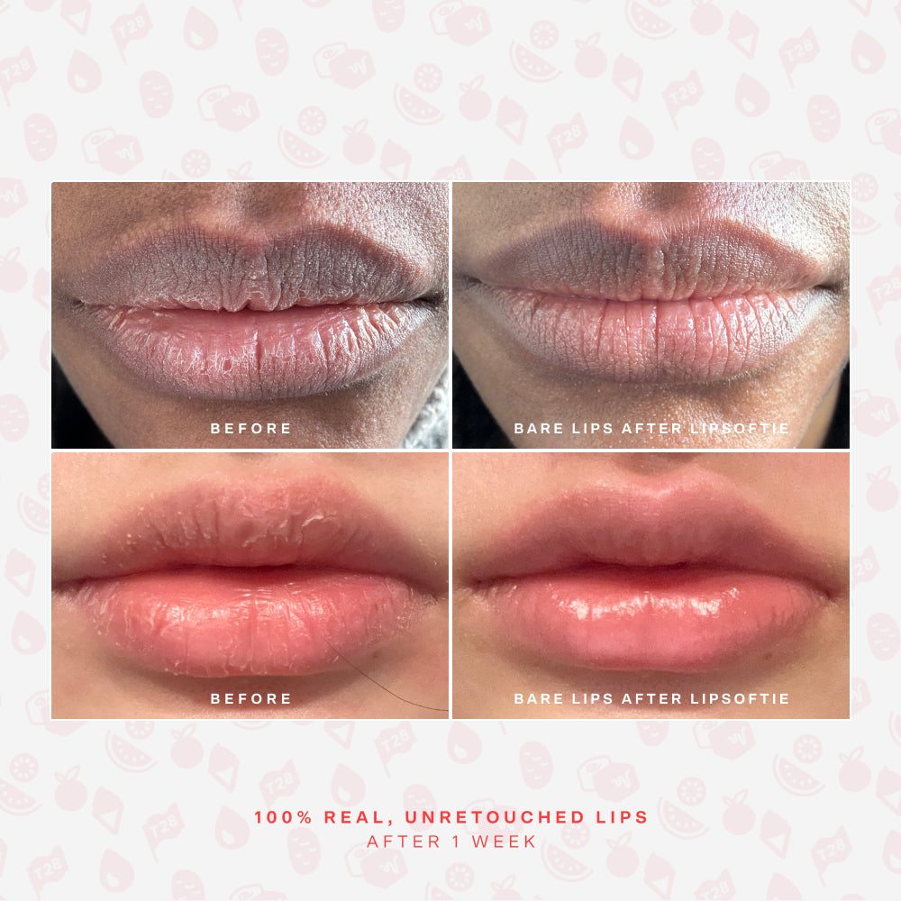 LipSoftie® Lip Treatment Set | Tower 28 Beauty
