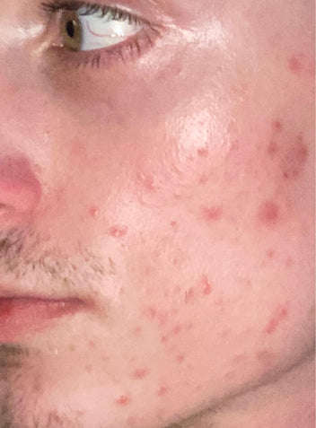 SOS Daily Rescue Facial Spray with Hypochlorous Acid | Tower 28 Beauty