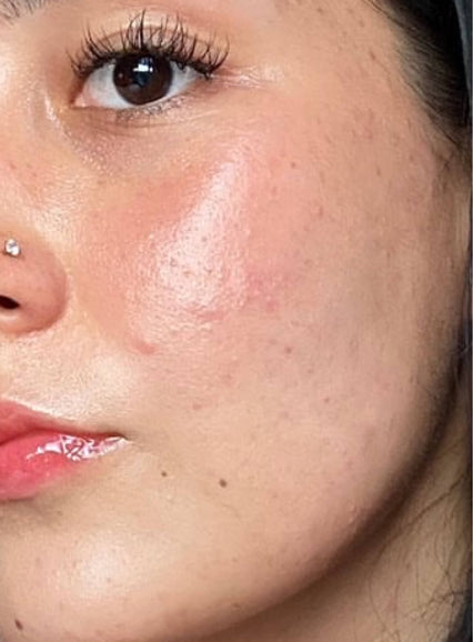 SOS Daily Rescue Facial Spray with Hypochlorous Acid | Tower 28 Beauty