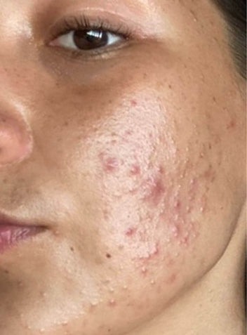 SOS Daily Rescue Facial Spray with Hypochlorous Acid | Tower 28 Beauty