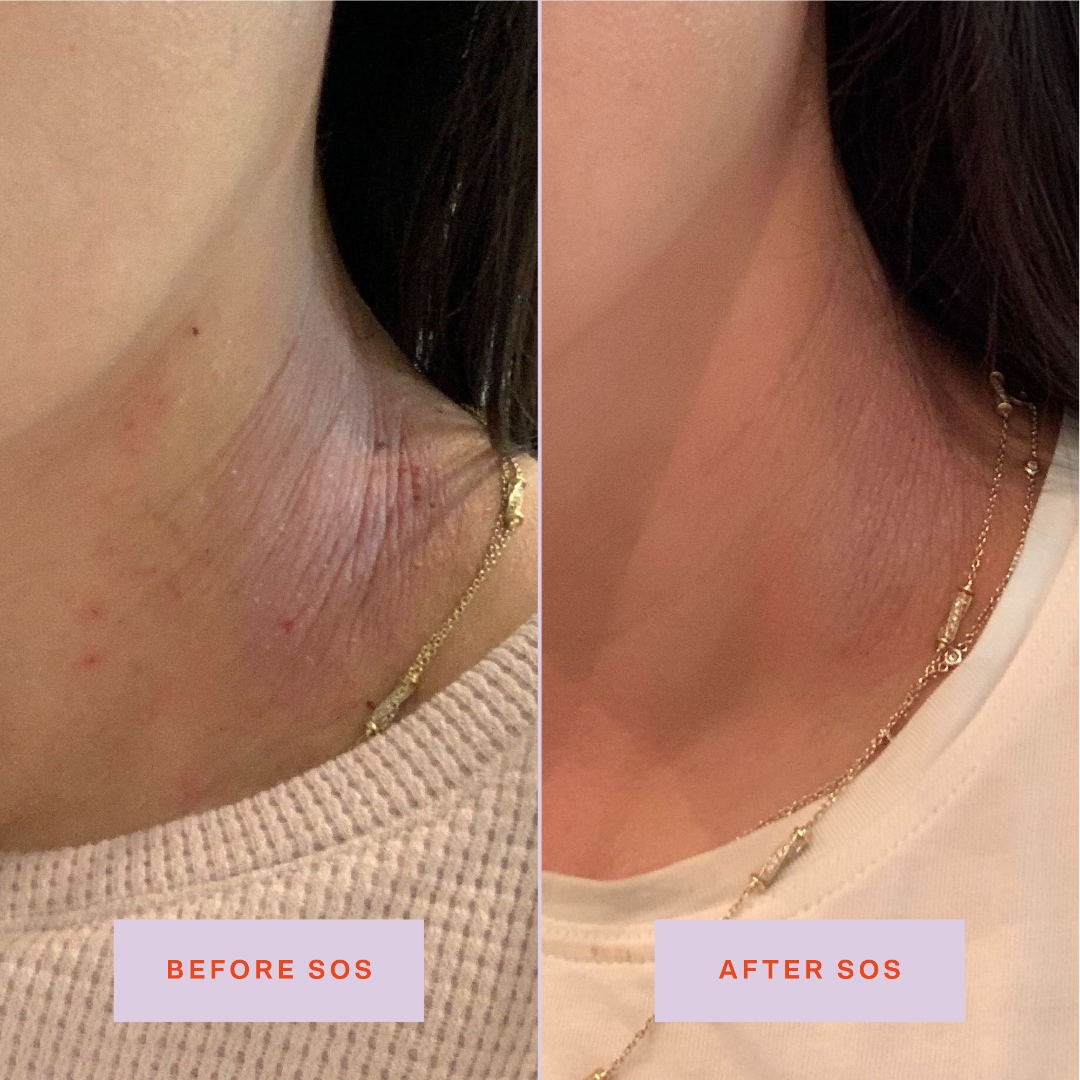 SOS Daily Rescue Facial Spray with Hypochlorous Acid | Tower 28 Beauty